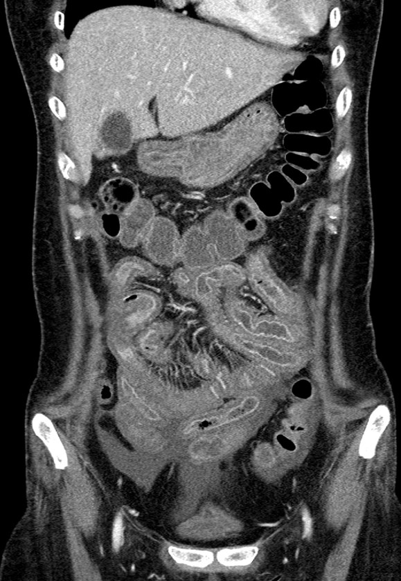 The Korean Society of Abdominal Radiology